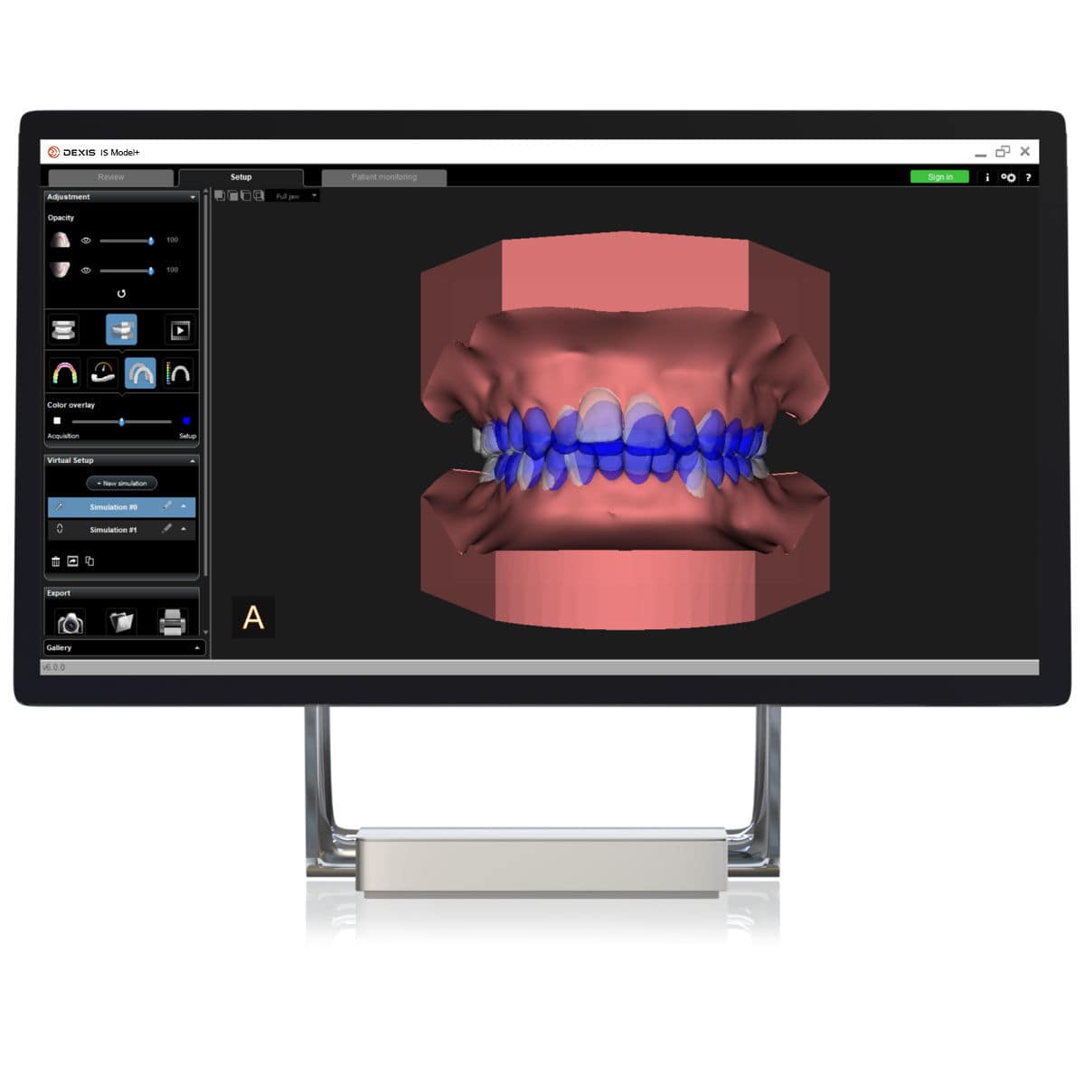 Software-Modul / Modellierung - CS Model+ - DEXIS - orthodontisch ...