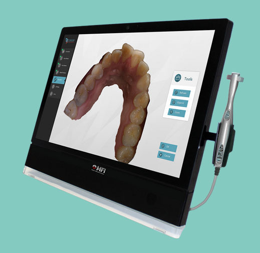 3D-Scanner für Zahnarztpraxis - CONDOR - Condor - intraoral