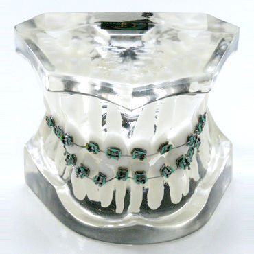 Anatomisches Modell / Gebiss - OTB2 - GF DENTAL - für Kieferorthopädie ...