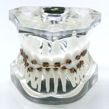 Anatomisches Modell / Gebiss - OTB6 - GF DENTAL - für Kieferorthopädie ...