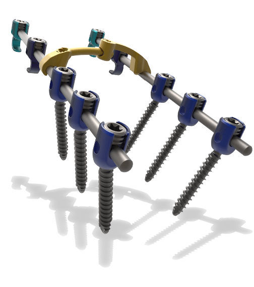 Zervikothorakales Stabilisierungssystem für Osteosynthese - Blackbird ...