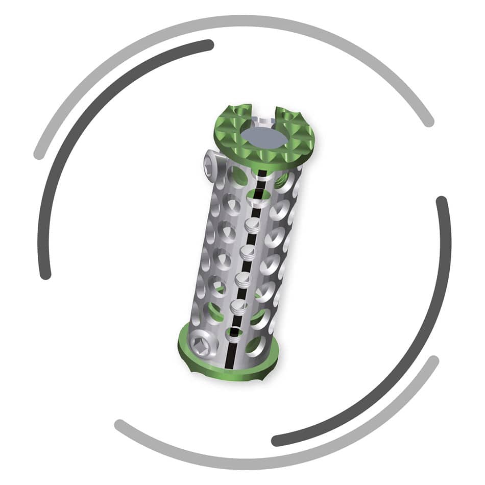 Korpektomie-Wirbelkörperprothese / HWS - PALIO - Signus Medical