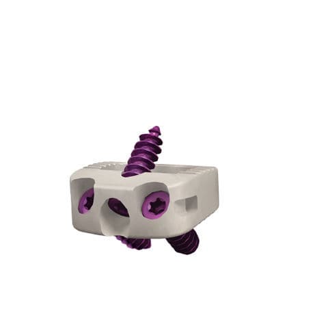 HWS-Zwischenwirbelimplantat - ACDF - NuVasive - ventraler Zugang