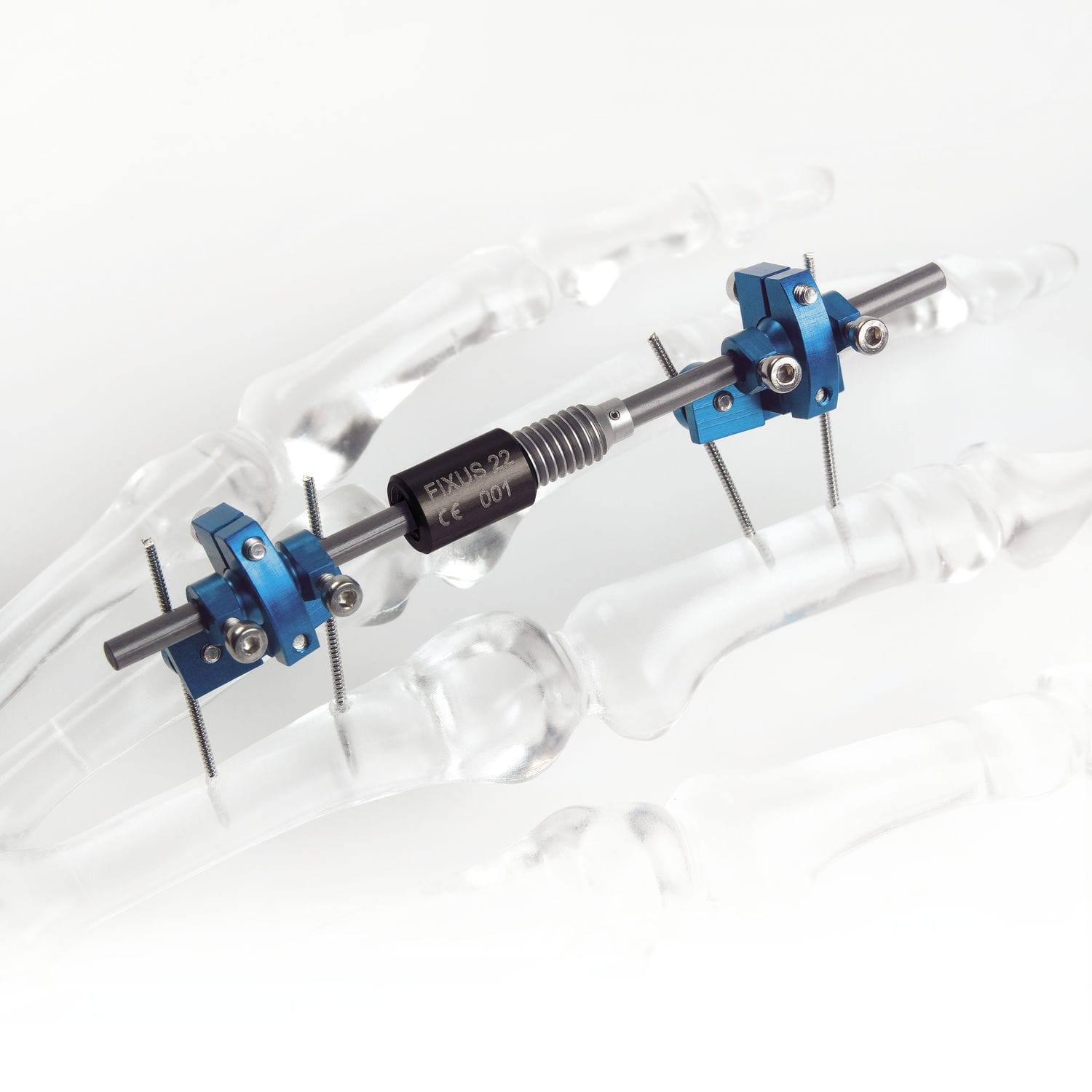 Fixateur externe für Fingergrundgelenk - FIXUS22 - Fixus - für Metatarsophalangealgelenk ...