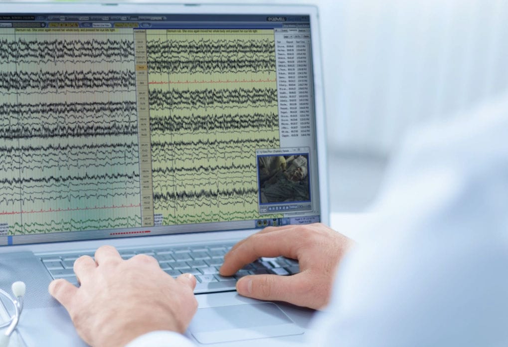 EEG-System / 128 Kanäle - EASY III - Cadwell Industries - für ...