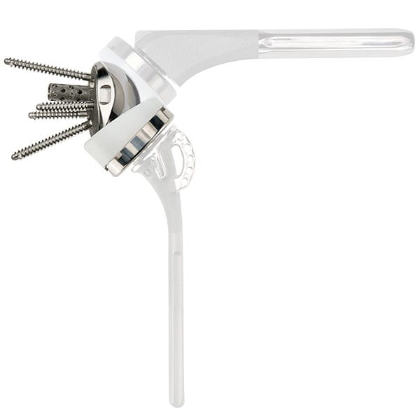 Inverse Schulterprothese - Equinoxe® - Exactech - zementiert