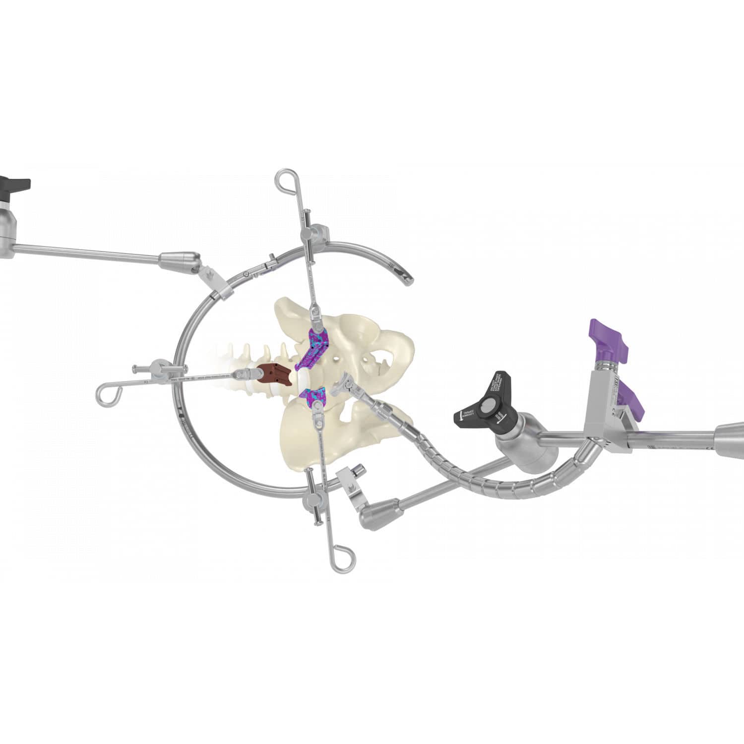 Wirbel-Retraktor - Phantom UL - TeDan Surgical Innovations - LWS / OP ...