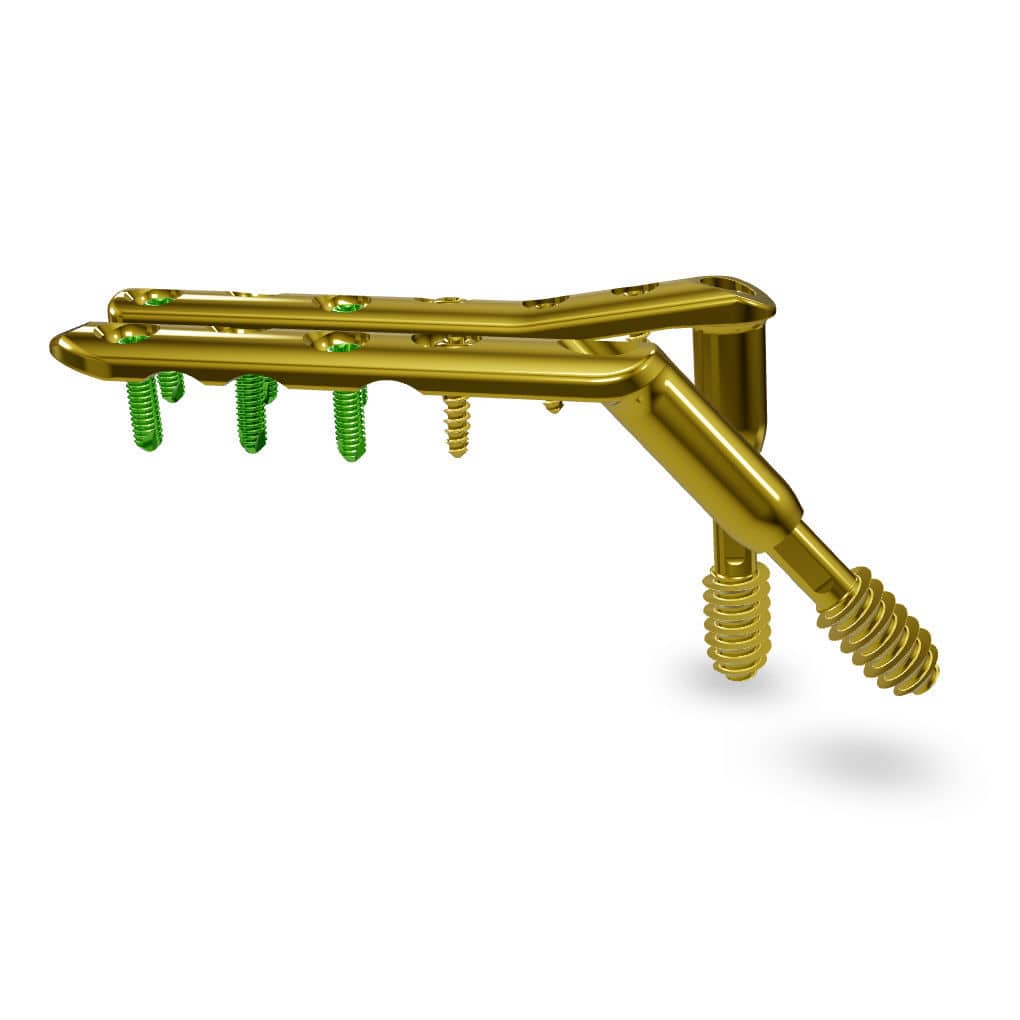 Kompressionsplatte für Oberschenkelknochen - 27.02.00.09506 - Astrolabe ...