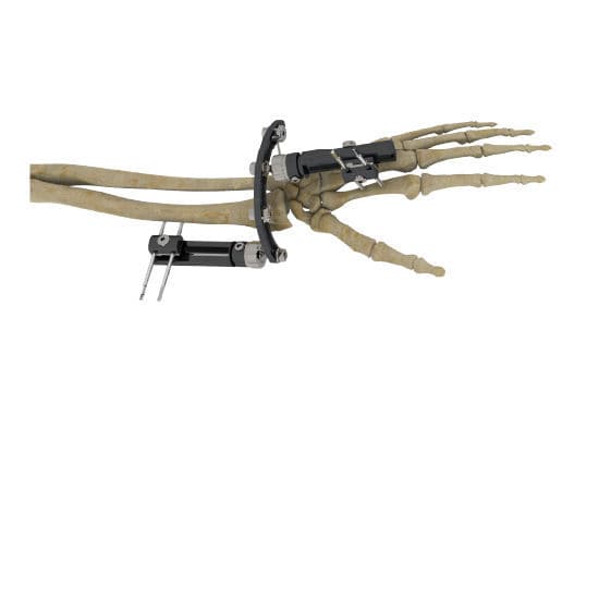 Fixateur externe / für Handgelenk - 5134-0000 - Zimed Medical - hybrid / für Erwachsene