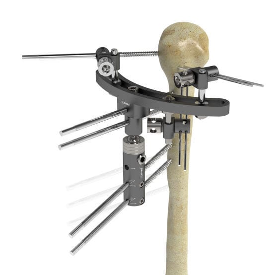 Fixateur externe / für Humerus - 5294-0000 - Zimed Medical - hybrid / für Erwachsene