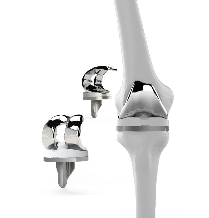 Femur Patella Knieprothese 7513 Zimed Medical Posterior 
