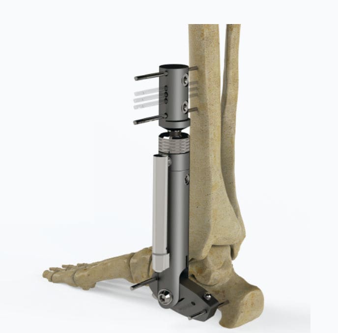 Fixateur externe / für Knöchel - 5064-000 series - Zimed Medical - rohrförmig / für Erwachsene