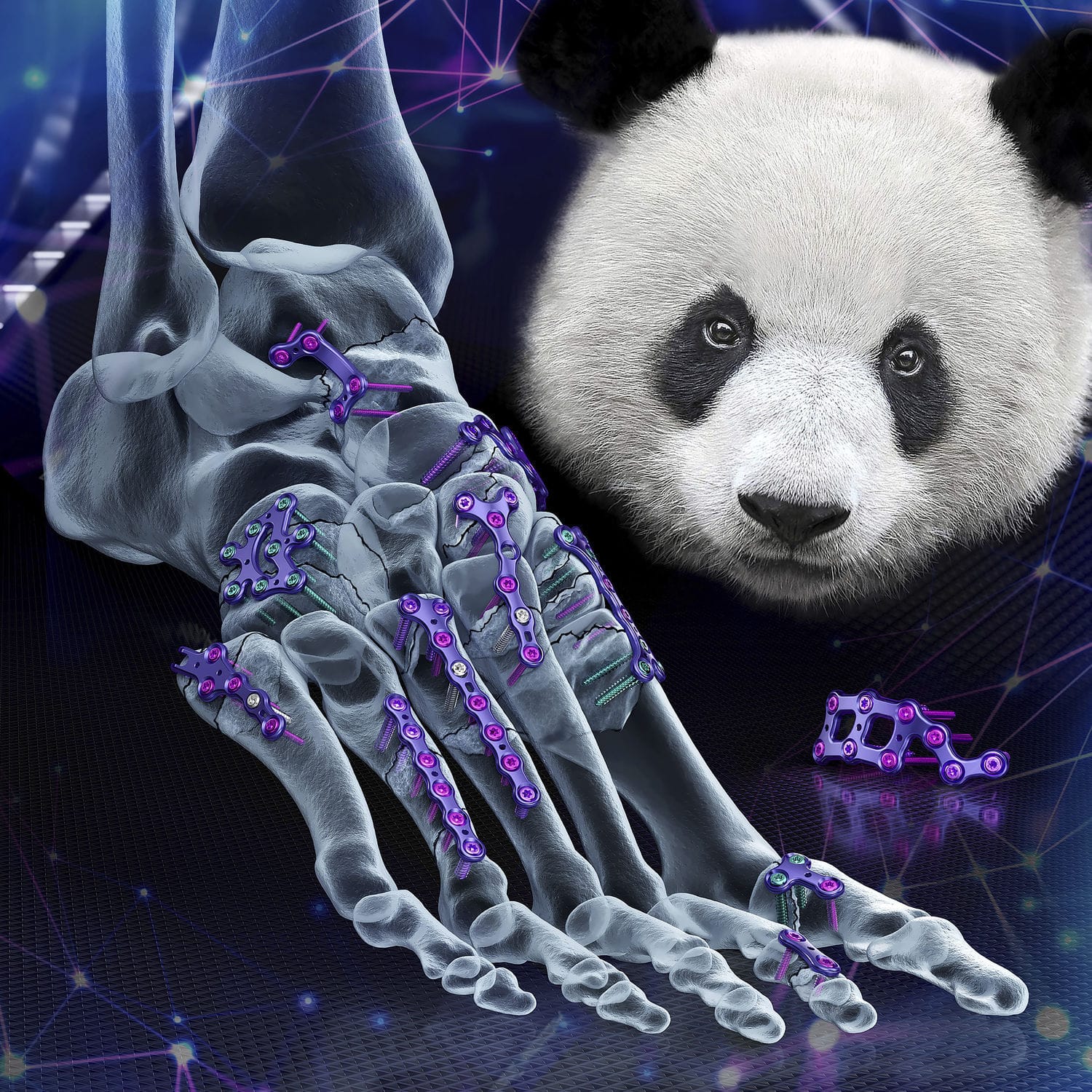 Kompressionsplatte für Zehenglied - PANDA - AGOMED Medizin-Technik ...