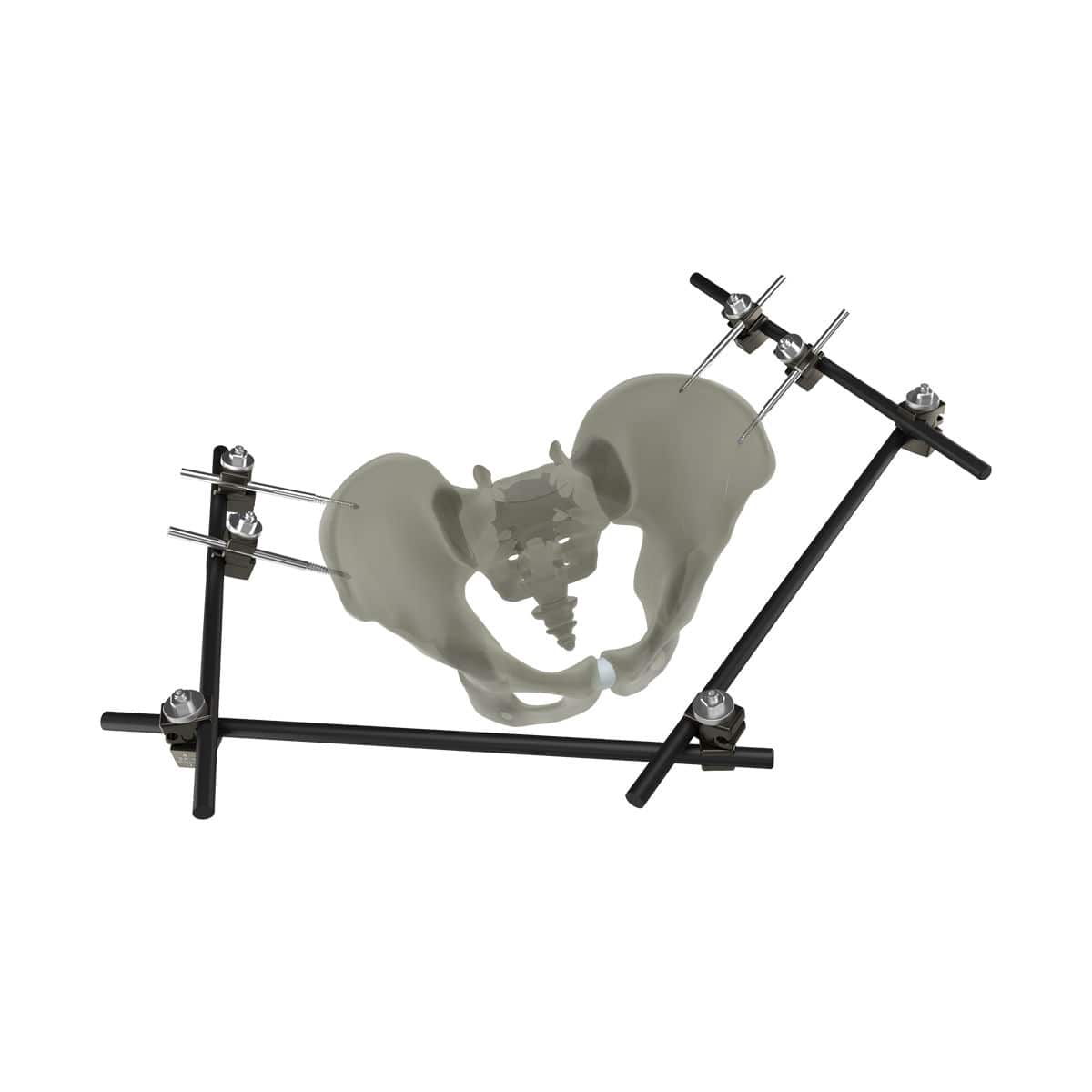 Fixateur externe / Becken - UniX® - WishBone Medical - rohrförmig / für Erwachsene