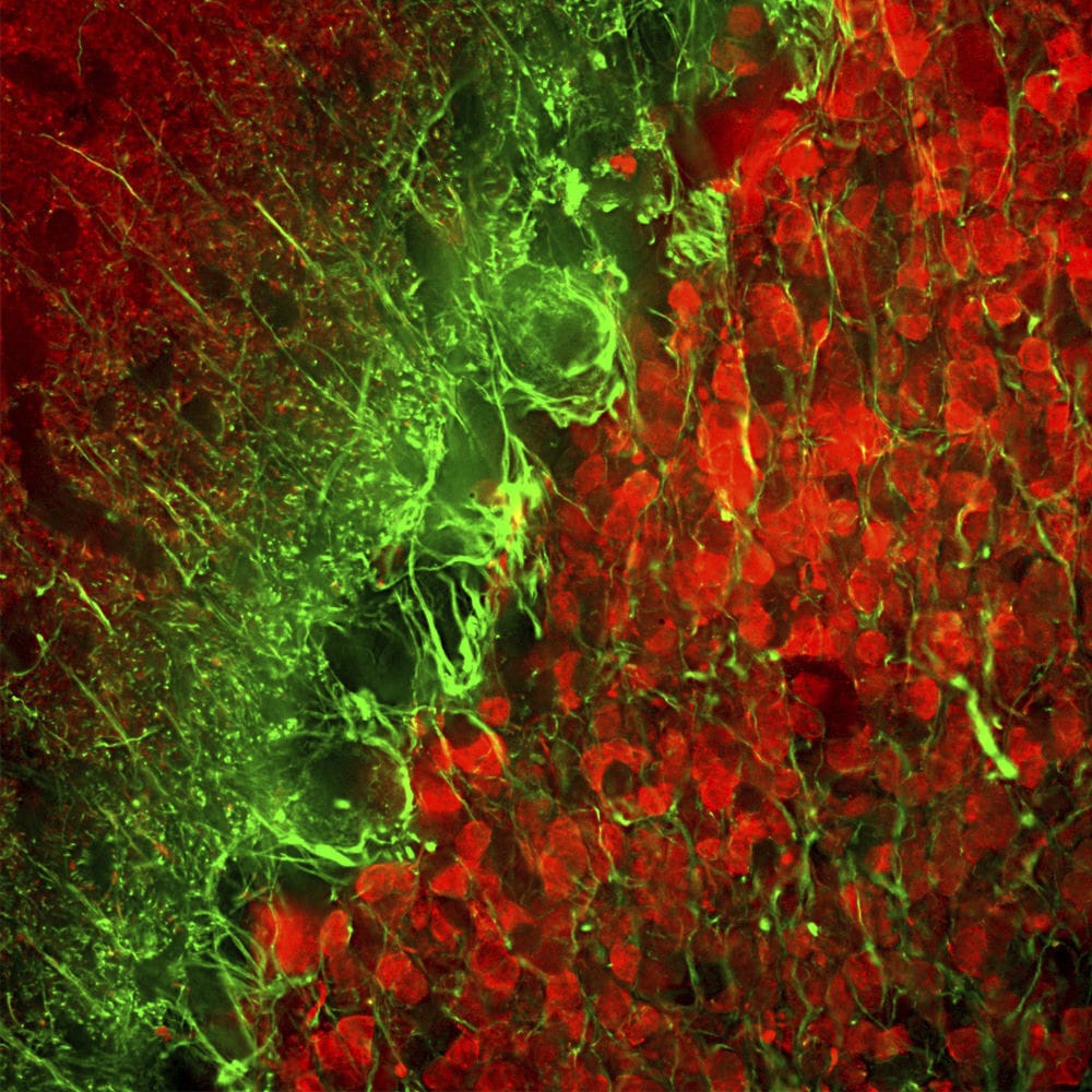 Reagenz für Alpha-Internexin - MO22154 - Neuromics - monoklonaler ...