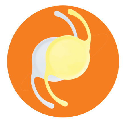 Multifokale Intraokularlinse - Nanex™ - HOYA Medical Singapore