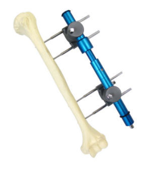 Fixateur externe / für Humerus - 563.10 - BAUMER - rohrförmig / für Erwachsene