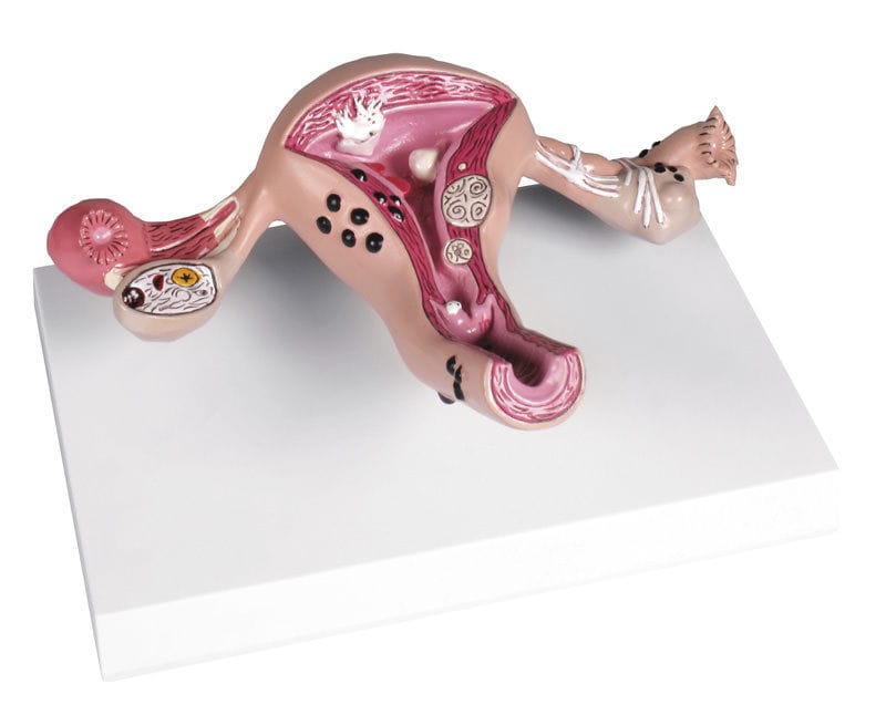Anatomisches Modell / Vagina - L262 - Erler-Zimmer - Gebärmutter / Uterus / Ovarien