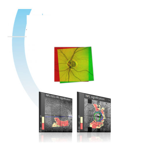 Software für Krankenhaus - iTracking™ - Optopol Technology - für ...