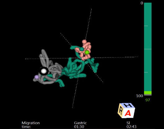 Endoskopie Kapsel / für endoskopische Untersuchung des ...
