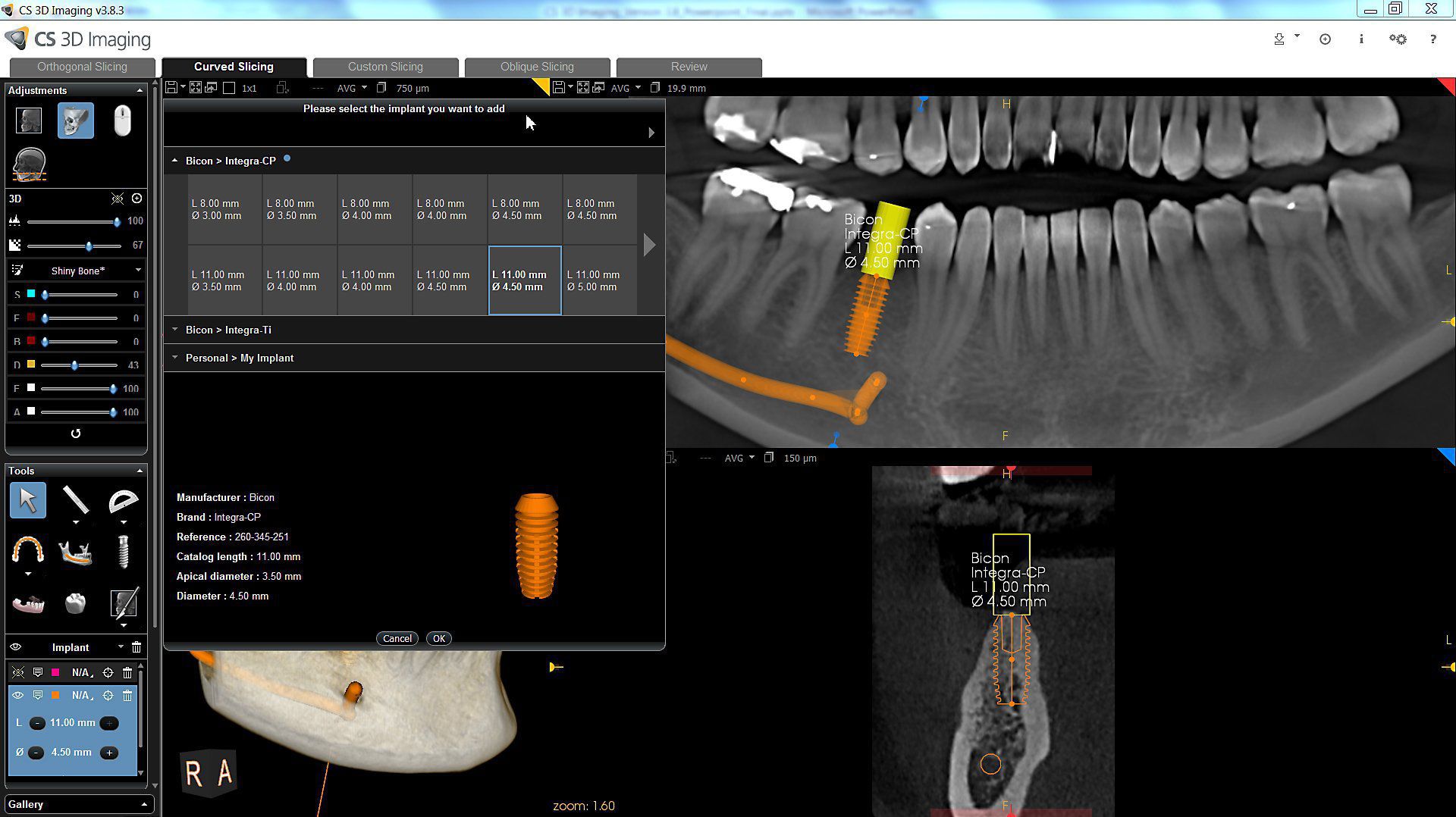 Orthodontische Software - Carestream Dental - für Zahnchirurgie / für ...