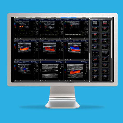 3D-Visualisierung-Software - ViewPoint™ 6 - GE Healthcare - Reporting ...