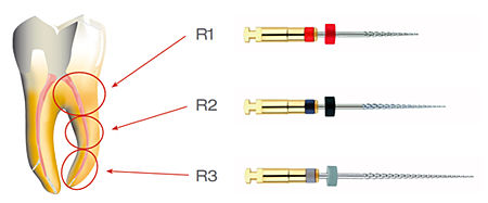 Endodontische Feile / Rotation - R-ENDO® - Micro-Mega - zur ...