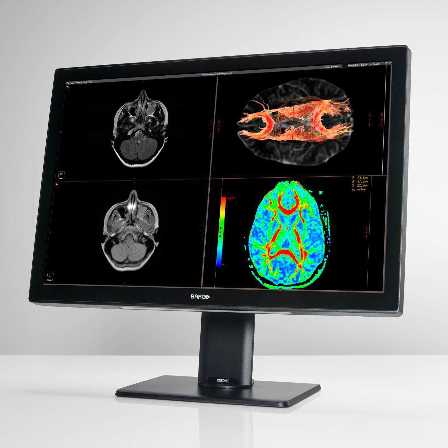 Diagnose-Monitor - MDCC-6530 - Barco - hochauflösend / 30,4" / LCD