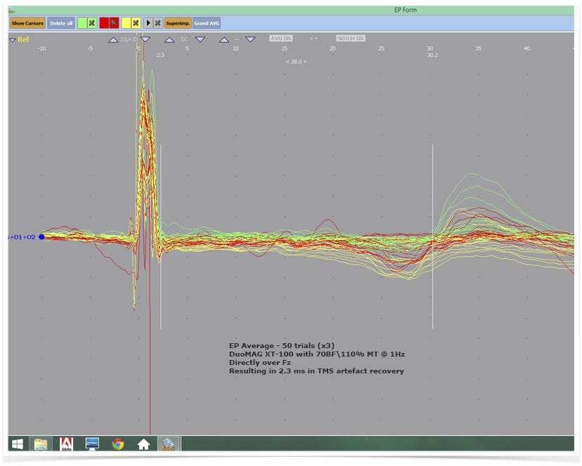 EEG-System / 128 Kanäle - TruScan Research - Brainbox - für ...