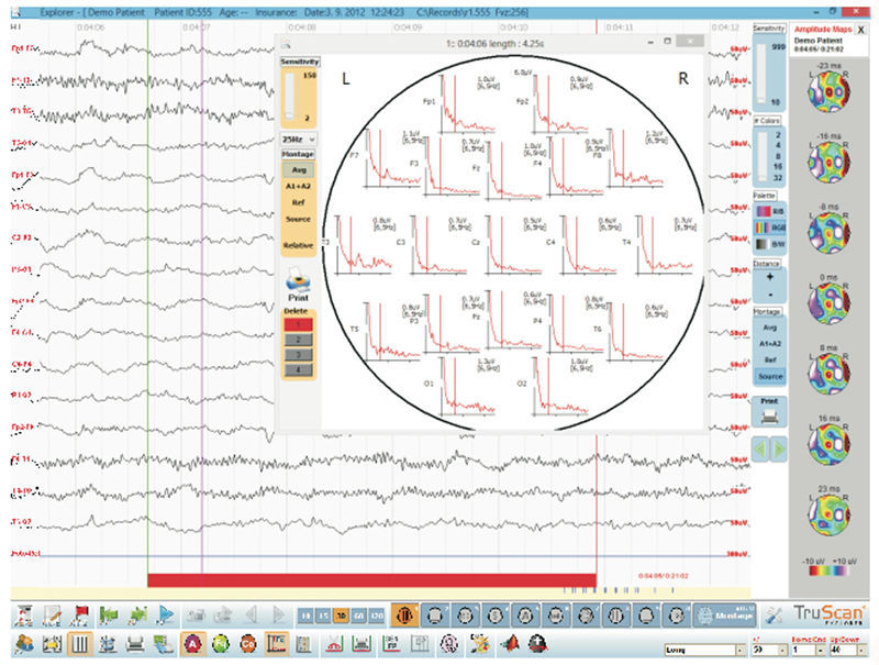 EEG-System / 128 Kanäle - TruScan Research - Brainbox - für ...