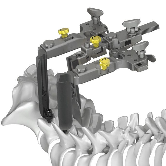 Retraktor für orthopädische Chirurgie - CENTRIC®-T - Life Spine