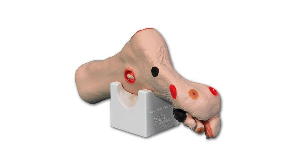 Anatomisches Modell / Fuß - 0950 - 'Wilma' Wound Foot™ - VATA, Inc ...