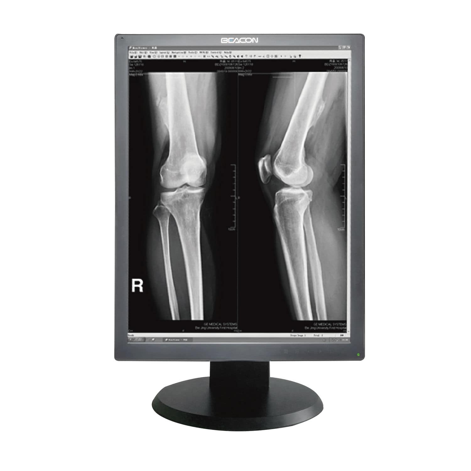 Diagnose-Monitor - G23S+ - Shenzhen Beacon Display Technology ...