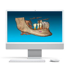 Implantat-Abutment / Titan - BioBlock® - BTI Biotechnology Institute ...