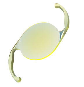 Monofokale Intraokularlinse - AcrySof® IQ - Alcon