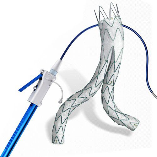 Stentgraft / Aorta abdominalis - Linus - Braile Biomedica - Nitinol