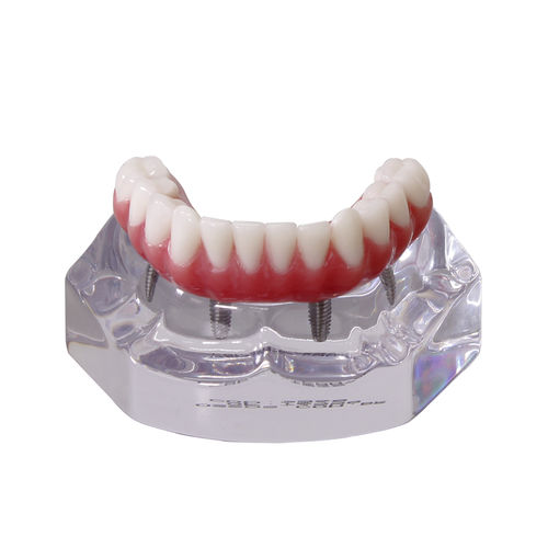 Anatomisches Modell / Gebiss - 9568 - Nacional Ossos - für ...