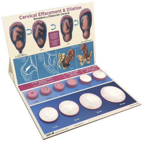 Anatomisches Modell / Gebärmutterhals - 79700 - Health Edco ...