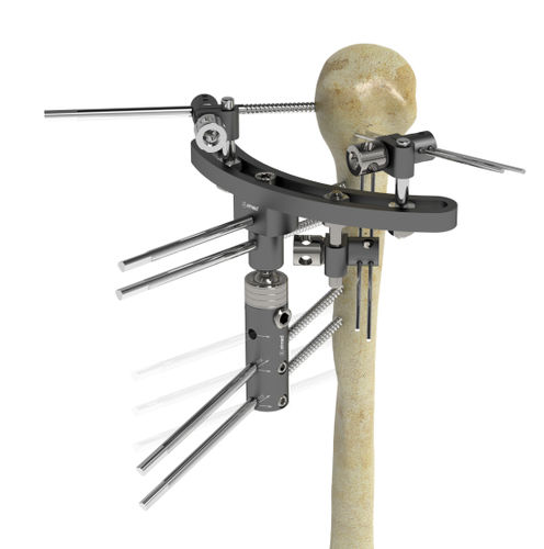 Fixateur externe / für Humerus - 5294-0000 - Zimed Medical - hybrid / für Erwachsene