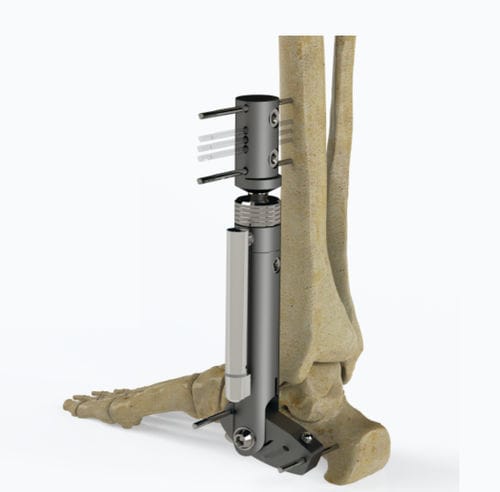 Fixateur externe / für Knöchel - 5064-000 series - Zimed Medical - rohrförmig / für Erwachsene