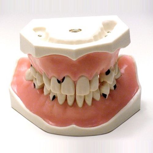 Anatomisches Modell / Gebiss - SP005 - Navadha Enterprises - für ...