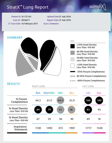 Analysesoftware - StratX® - pulmonX - Reporting / Mess / Erfassung