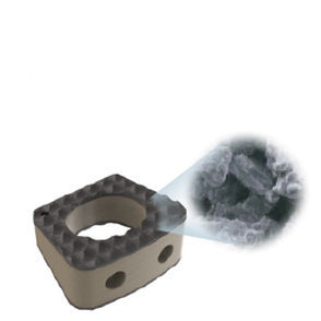 HWS-Zwischenwirbelimplantat - ShurFit® ACIF 2C - Precision Spine ...