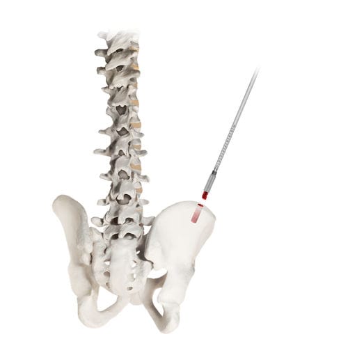 Knochenmarkbiopsienadel - RETRIEVE® - Globus Medical