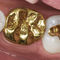 Zahnmedizinisches Material / Legierung - Full-Cast Gold - Glidewell ...