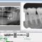 Orthodontische Software - Mediadent v8 - IMAGELEVEL - für dentale ...
