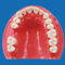 Anatomisches Modell / Gebiss - MIS-HD Series - Nissin Dental Products ...