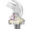 Femur-Patella Knieprothese - ATTUNE™ - Depuy Synthes - Revision ...